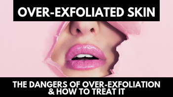 Over-Exfoliated Skin: The Dangers Of Over-Exfoliation & How To Treat It ...